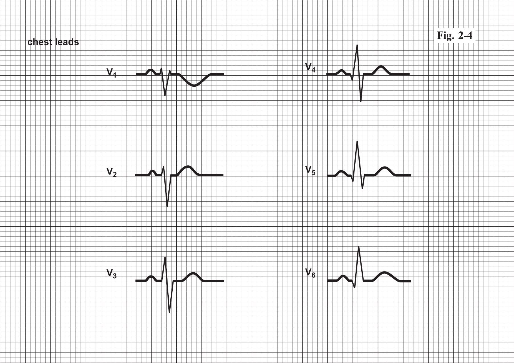 ECG Leads | SpringerLink