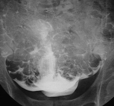 Diagnosis of a Lump in the Groin in the Adult | SpringerLink