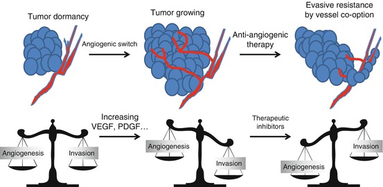 Angiogenesis and Invasion in Malignant Glioma: Friends or Foes? | SpringerLink