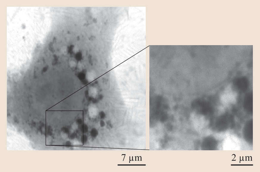 Zone-Plate X-Ray Microscopy | SpringerLink