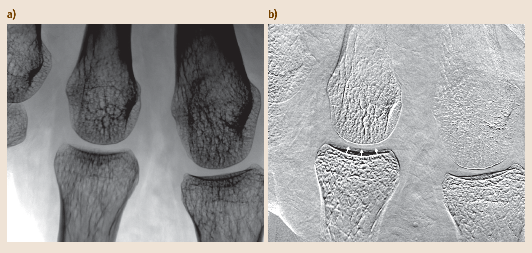 Biomedical X-Ray Phase-Contrast Imaging and Tomography | SpringerLink