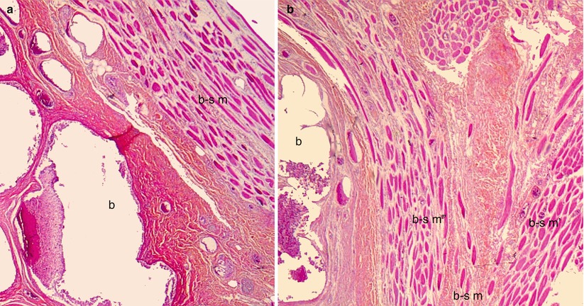 Muscles of the Bulbo-clitoral Organ | SpringerLink