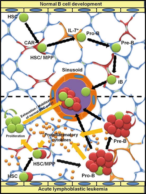 Early Hematopoietic Differentiation in Acute Lymphoblastic Leukemia ...