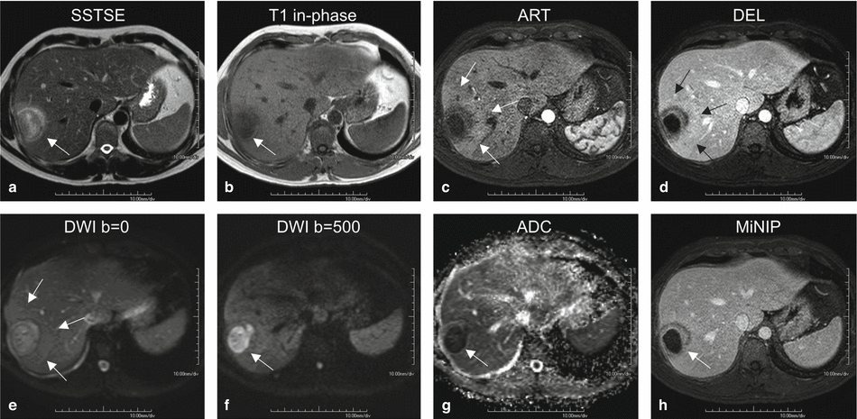 MRI Technique, Contrast, Safety, Anatomy, and Differential | SpringerLink