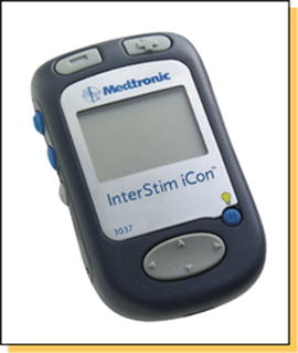 Sacral Nerve Modulation for Fecal Incontinence | SpringerLink