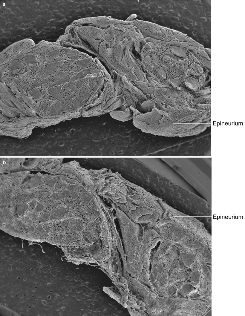 Ultrastructure of the Epineurium | SpringerLink