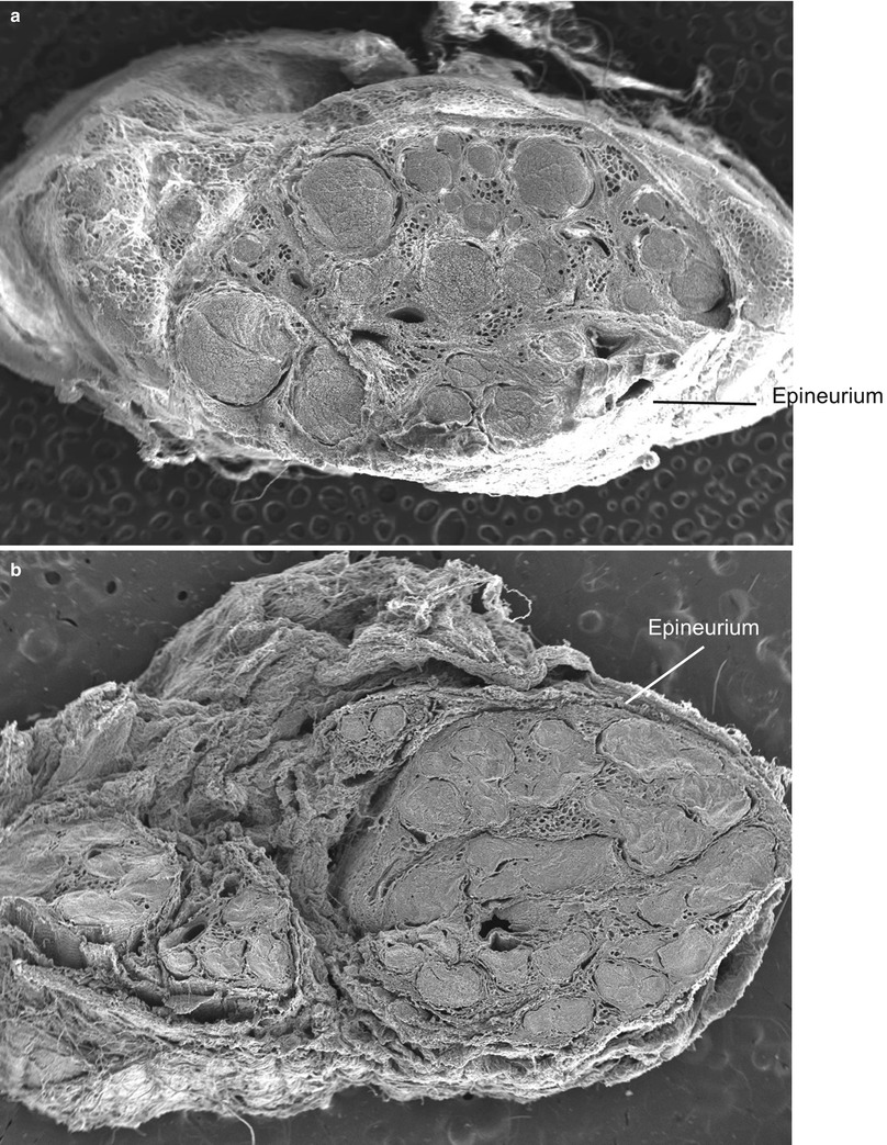 Ultrastructure of the Epineurium | SpringerLink