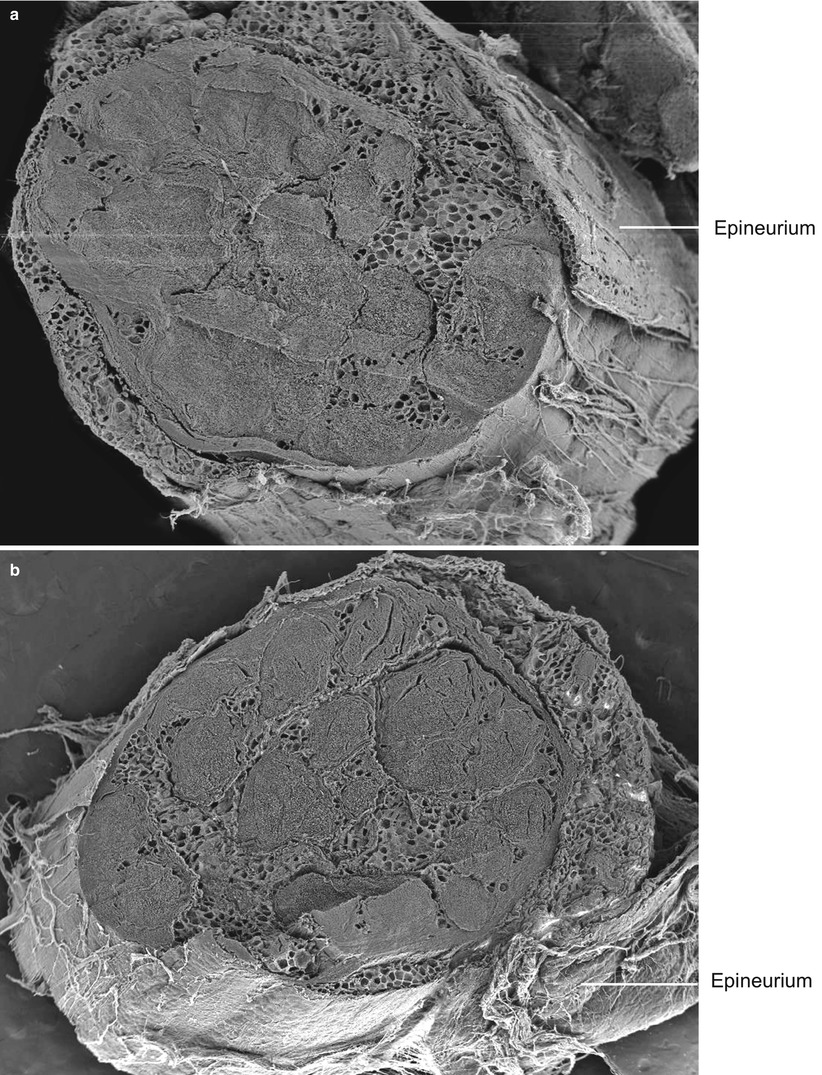 Ultrastructure of the Epineurium | SpringerLink