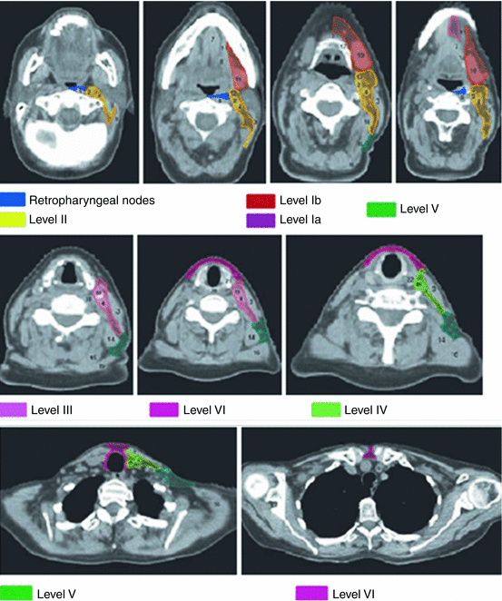 General Concepts in Head and Neck Radiotherapy | SpringerLink