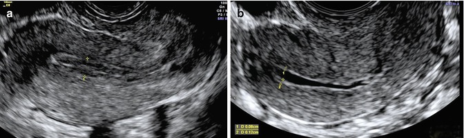 Female Reproductive System | SpringerLink