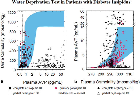 Water Deprivation Test | SpringerLink