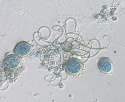 Basic Mycology | SpringerLink