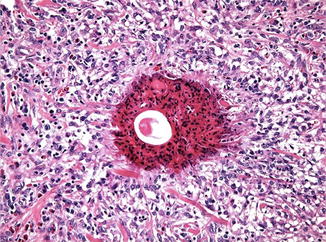 Habronemosis | SpringerLink