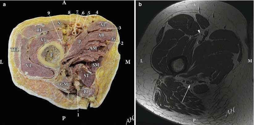 Lower Extremity Axial Cuts | SpringerLink
