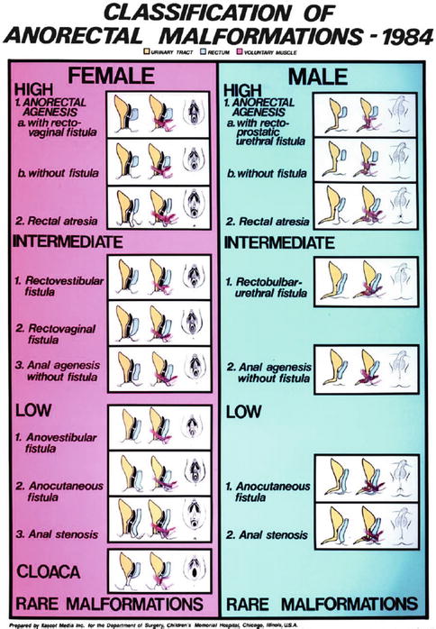 History of the Treatment of Anorectal Malformations | SpringerLink