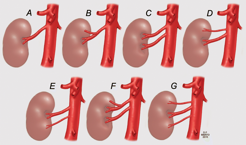 Normal Aortic Anatomy and Variations of Its Branches | SpringerLink