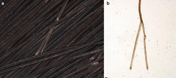 Clinical Signs of Hair Damage | SpringerLink