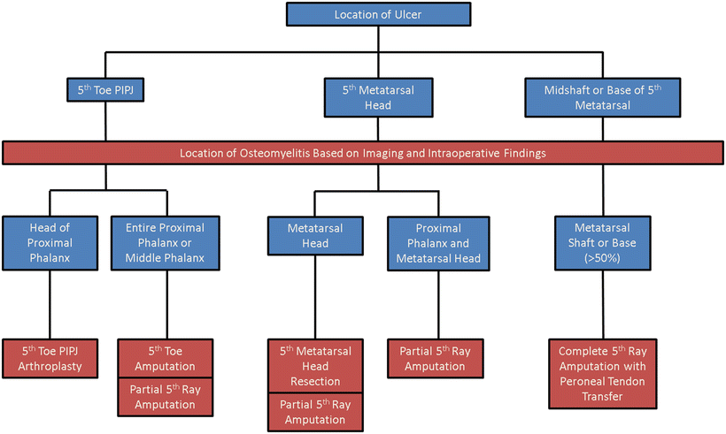 Fifth Ray Osteomyelitis | SpringerLink
