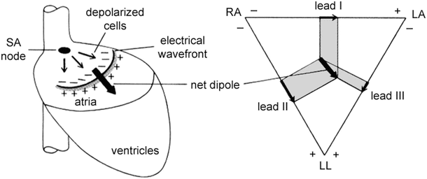 Basic ECG Theory, 12-Lead Recordings, and Their Interpretation ...