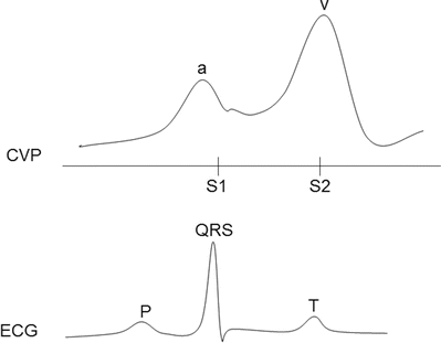 Mechanical Aspects of Cardiac Performance | SpringerLink