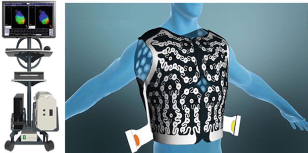 Cardiac Mapping Technology | SpringerLink