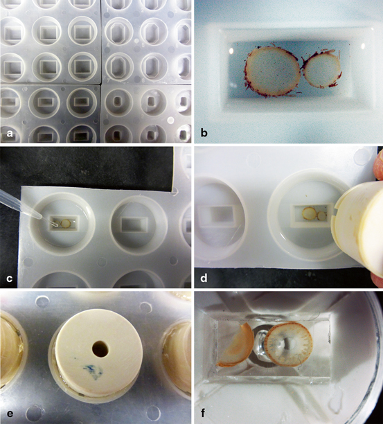 The Glycol Methacrylate Embedding Resins—Technovit 7100 and 8100 | SpringerLink