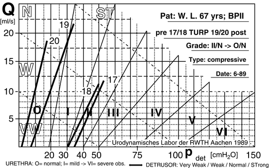 Nomograms | SpringerLink