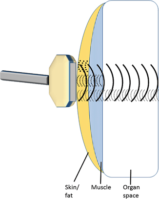 Overview of Ultrasound Theory and Techniques | SpringerLink