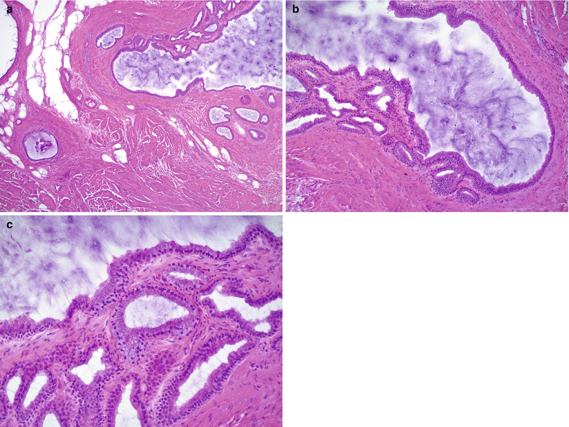 Peritoneum | SpringerLink