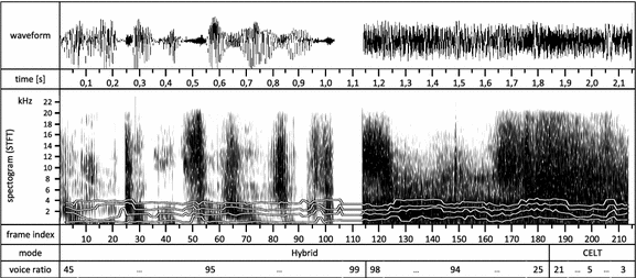 Review of the Opus Codec in a WebRTC Scenario for Audio and Speech ...
