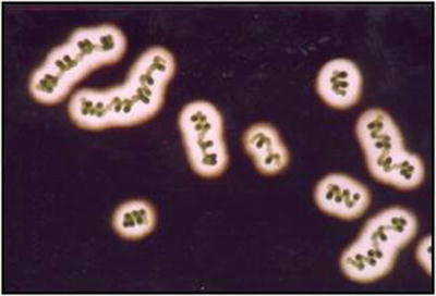 Exocellular Polysaccharides in Microalgae and Cyanobacteria: Chemical ...