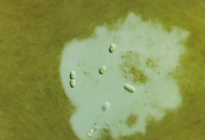 Exocellular Polysaccharides in Microalgae and Cyanobacteria: Chemical ...