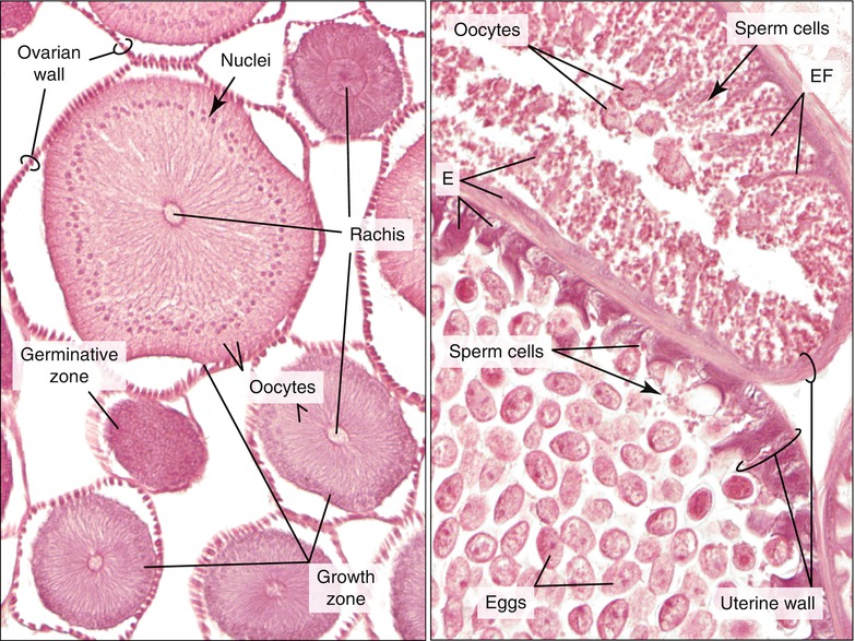 Dissection of a Roundworm ( Ascaris suum) | SpringerLink