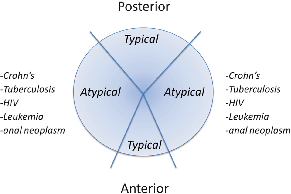Anal Fissure | SpringerLink
