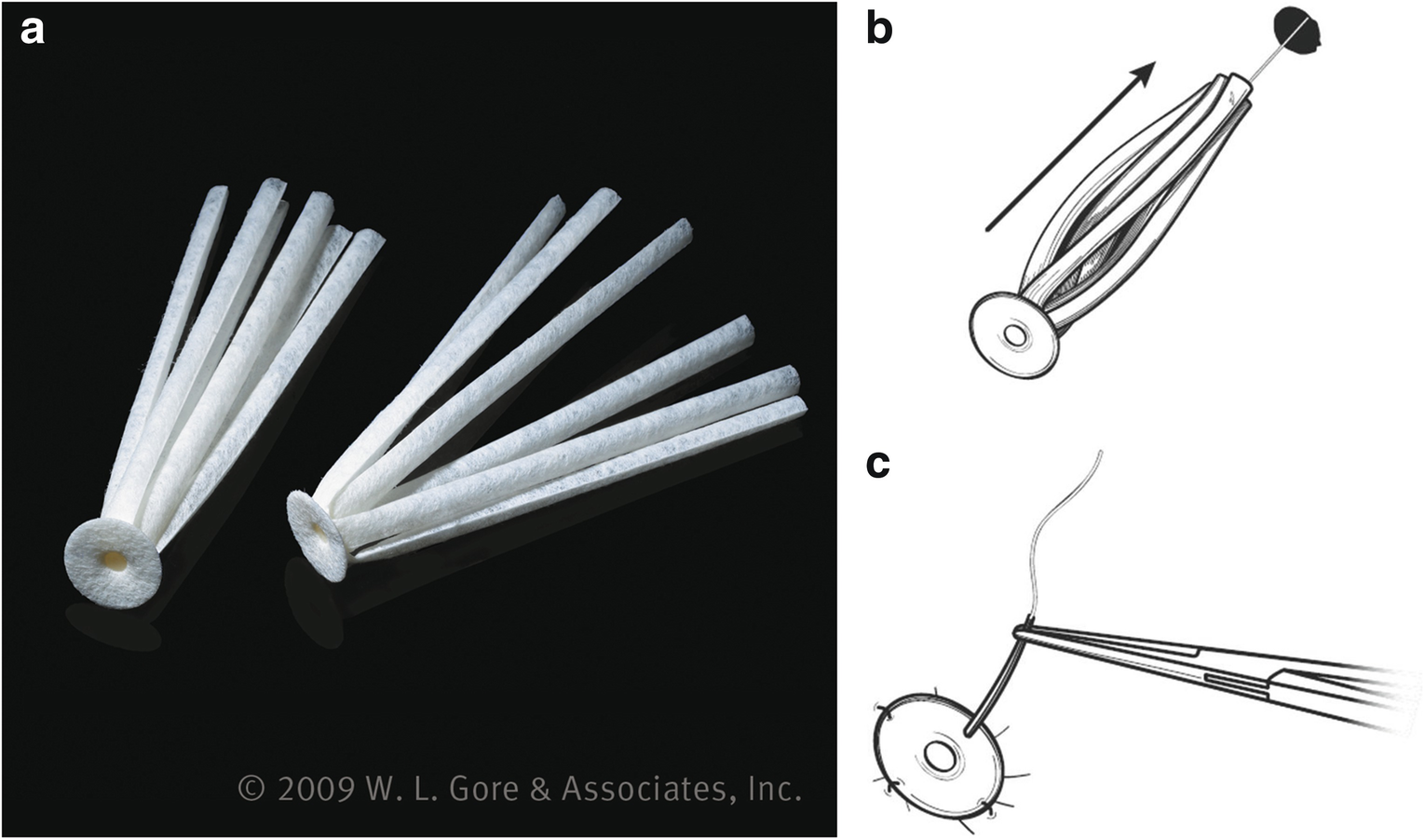 Complex Anorectal Fistulas | SpringerLink