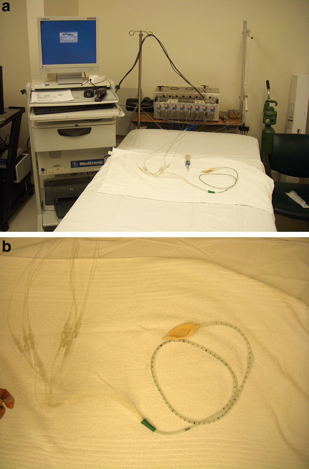 Complex Anorectal Fistulas | SpringerLink