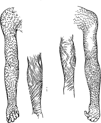 Langer’s Lines | SpringerLink