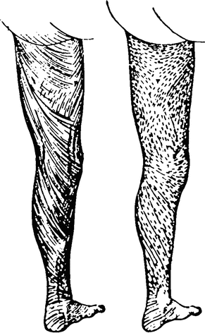 Langer’s Lines | SpringerLink