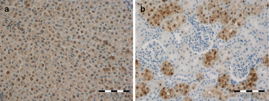 Metallothioneins: Structure and Functions | SpringerLink