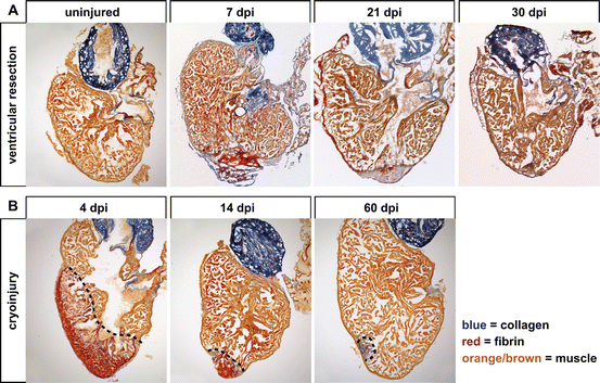 Cardiac Regeneration in Zebrafish | SpringerLink