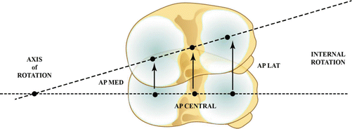 Navigating the Pivot-Shift Test | SpringerLink