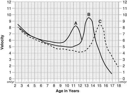 Constitutional Delayed Puberty | SpringerLink