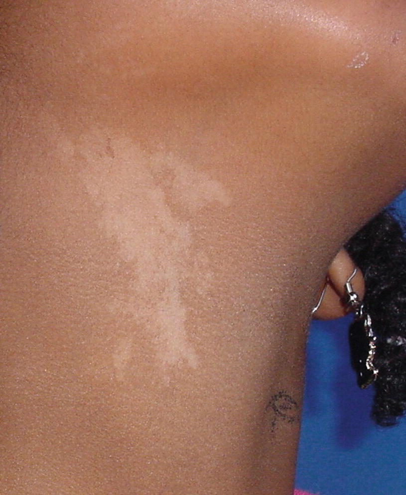 Stains | SpringerLink