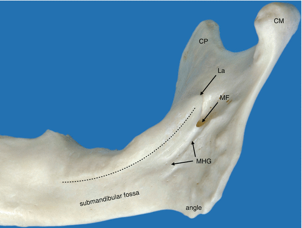 Posterior Mandible | SpringerLink