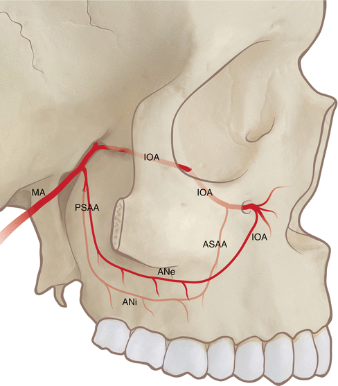 Posterior Maxilla | SpringerLink