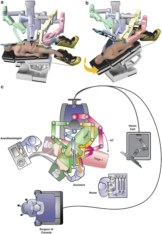 Robotic Low Anterior Resection of Rectal Cancer | SpringerLink