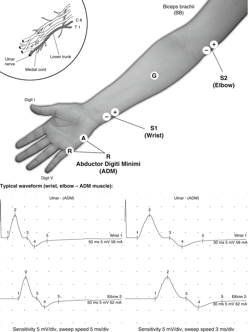 Wrist, Elbow – Hand | SpringerLink