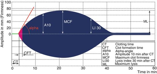 Coagulation Monitoring | SpringerLink