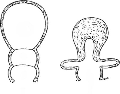 Cesarean Section: The Evidence-Based Technique, Complications, and ...