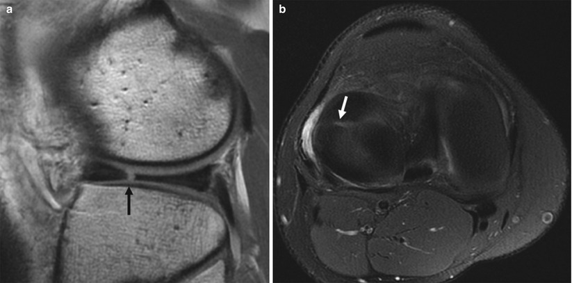 Imaging of the Knee | SpringerLink